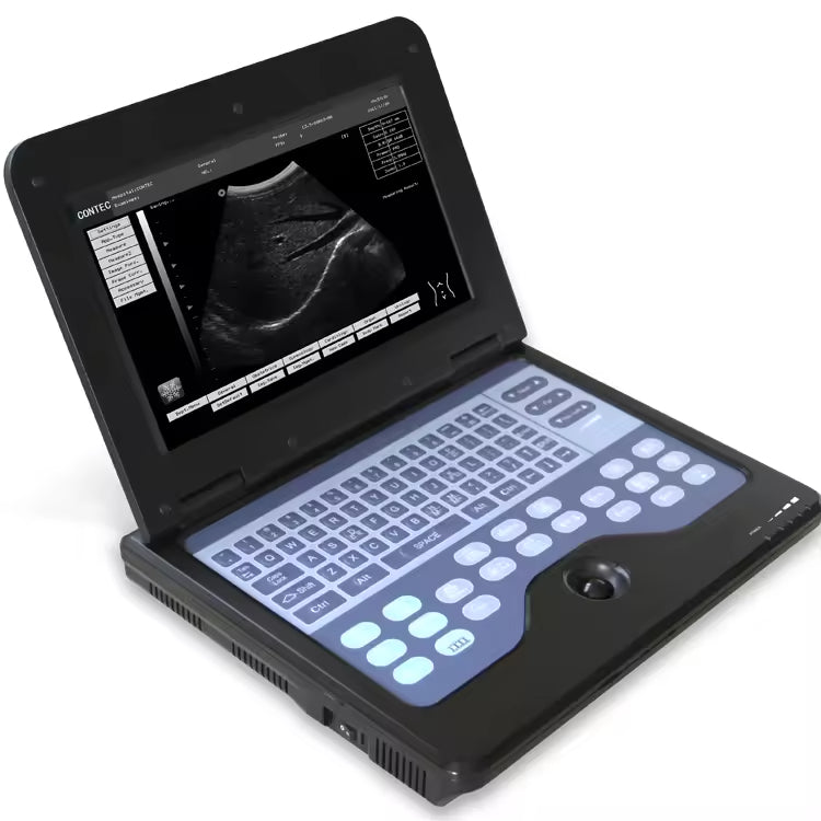 JYTOP CMS600P2 Portable B Ultrasound Machine