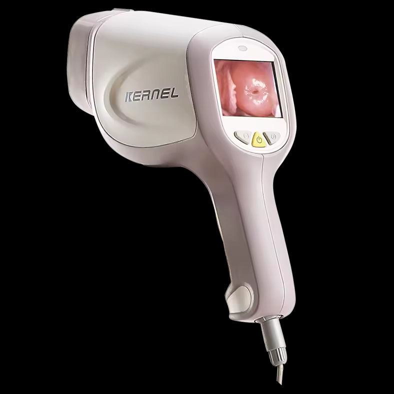 KN2200I HD CCD Camera Digital Video Kernel Optic Colposcope for Gyneco ...