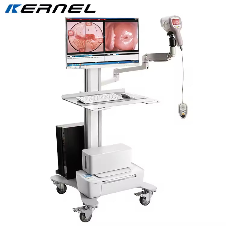 KN2200I HD CCD Camera Digital Video Kernel Optic Colposcope for Gyneco ...